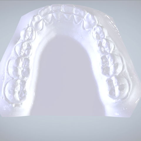Download STL file Digital ABO Planning Study Models ・ Cults