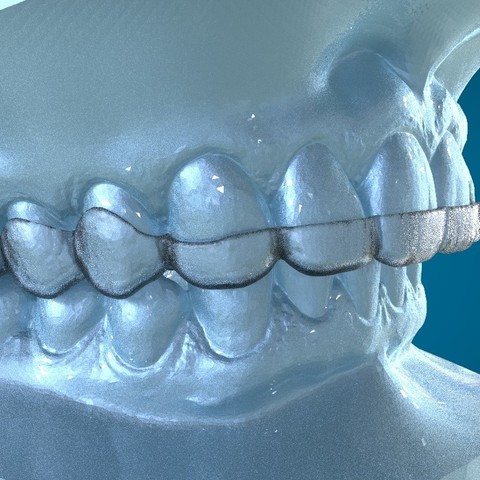 Download OBJ file Digital Dental Dayguard Splint • Design to 3D print ...
