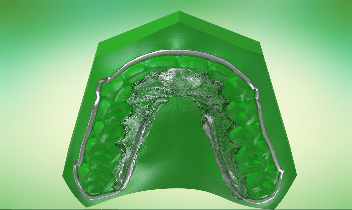 Download OBJ file Digital Ortho Kois Deprogrammer Appliance • 3D ...