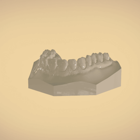 Download STL files Digital Orthodontic Study Models with Virtual Bases ...