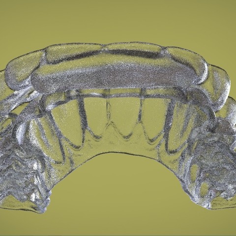 Download STL Digital Dental B Splints ・ Cults