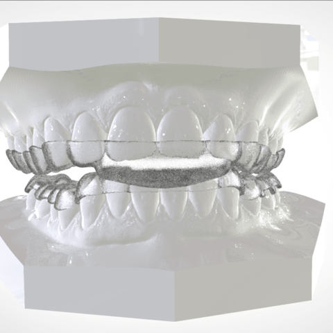 Download STL Digital Dental B Splints ・ Cults