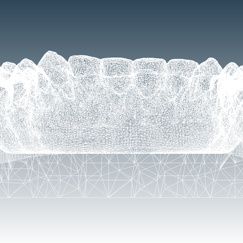 Download STL file Digital ABO Planning Study Models ・ Cults