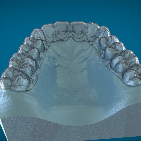 Download OBJ file Digital Dental Dayguard Splint • Design to 3D print ...