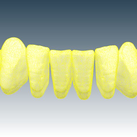 Download 3D printing designs Digital Full Dentures for Gluedin Teeth ...