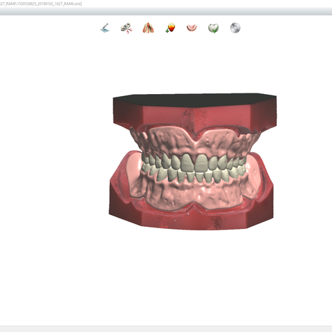 Download 3D printer files Digital Try-in Full Dentures for Injection ...