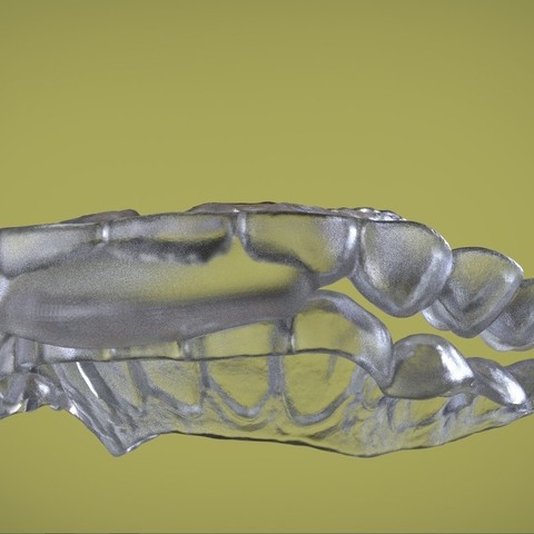 Download STL Digital Dental B Splints ・ Cults
