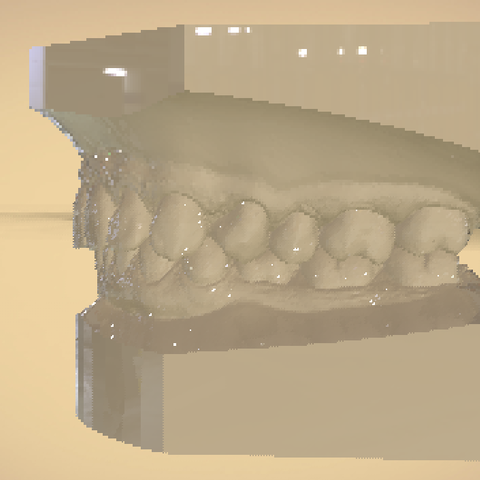 Download STL files Digital Orthodontic Study Models with Virtual Bases ...