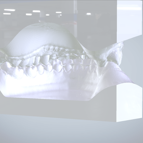 Download STL file Digital ABO Planning Study Models ・ Cults