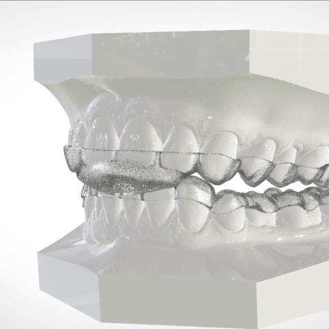 Download STL Digital Dental B Splints ・ Cults