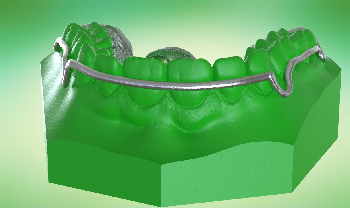 Download OBJ file Digital Ortho Kois Deprogrammer Appliance • 3D ...