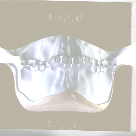 Download 3D printer files Digital Try-in Full Dentures for Injection ...