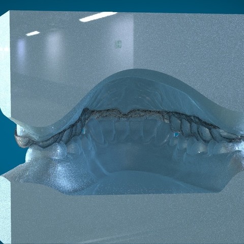 Download OBJ file Digital Dental Dayguard Splint • Design to 3D print ...