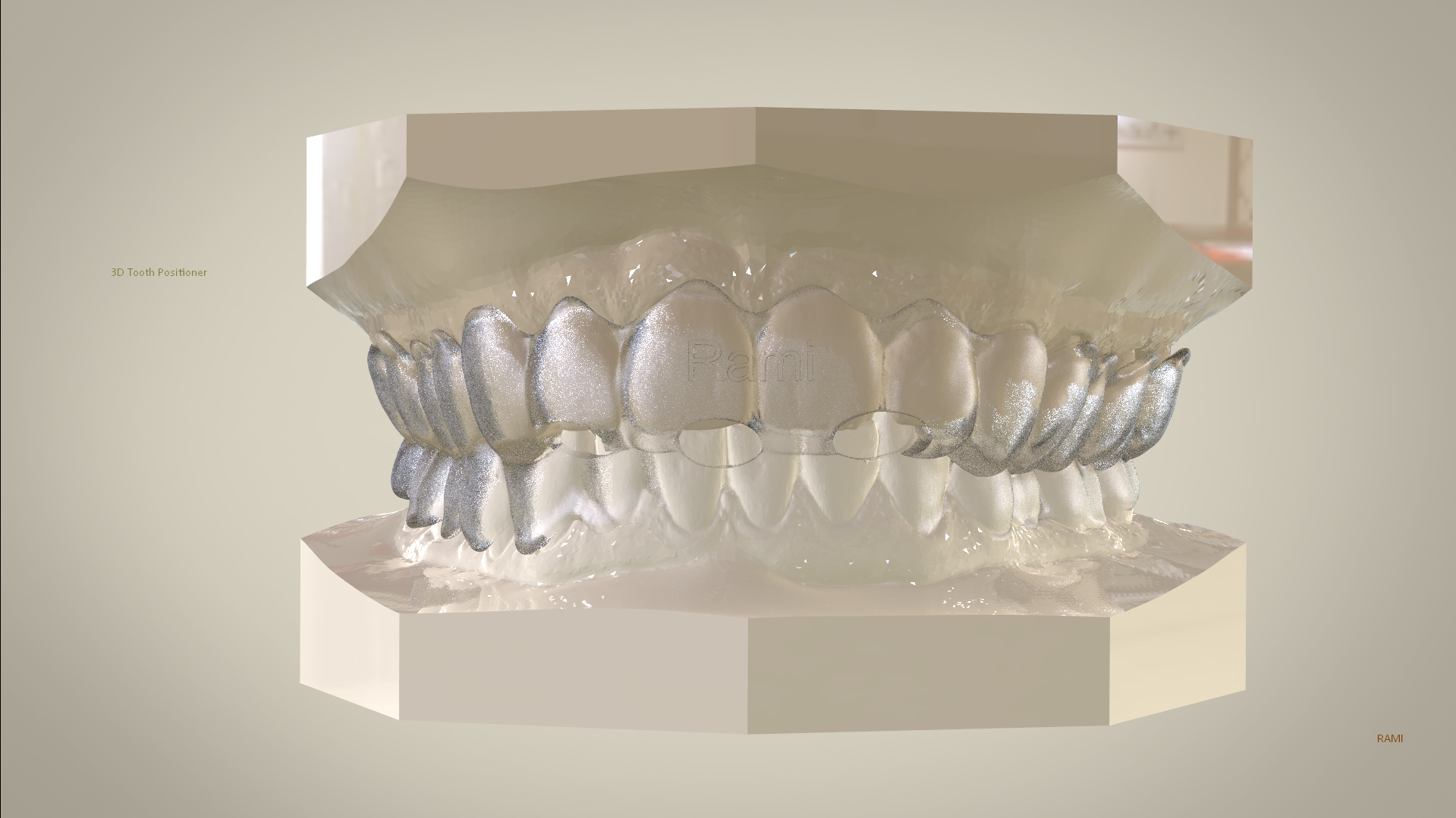Descargar archivo STL Digital Tooth Positioner • Plan para la impresión ...
