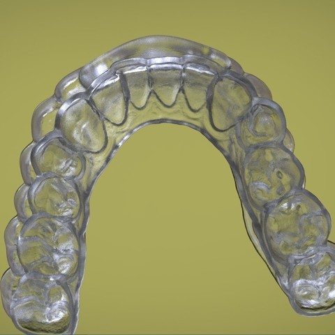 Download STL Digital Dental B Splints ・ Cults