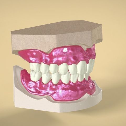 Download 3D printer designs Digital Full Dentures ・ Cults
