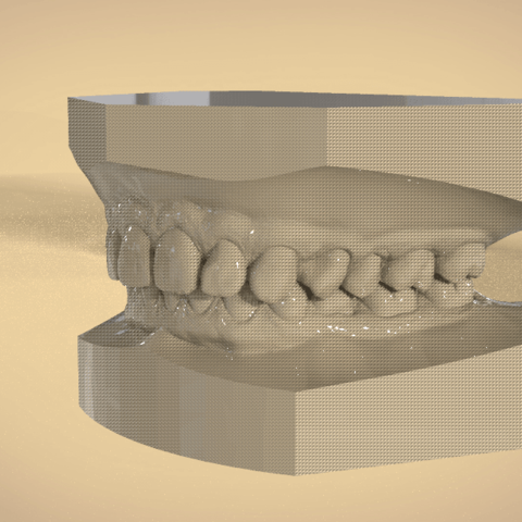 Download STL files Digital Orthodontic Study Models with Virtual Bases ...