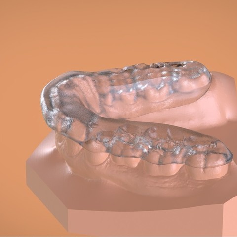 Descargar archivo 3D Férula de bronceado mandibular digital ・ Cults