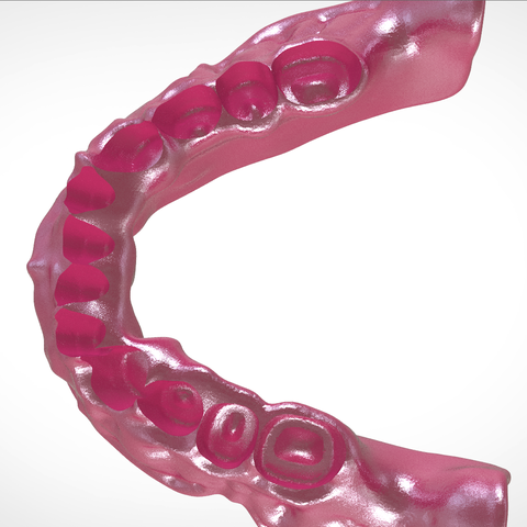 Download 3D printing designs Digital Full Dentures for Gluedin Teeth ...