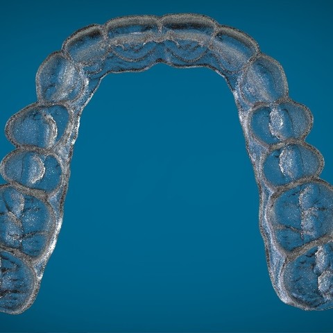 Download OBJ file Digital Dental Dayguard Splint • Design to 3D print ...
