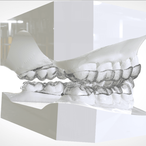 Download STL Digital Dental B Splints ・ Cults