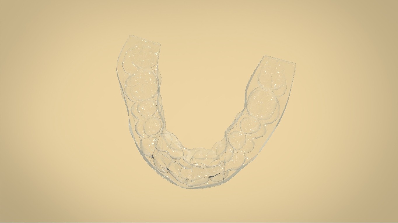 STL file Digital Anti Snoring Splint・3D printing template to download・Cults