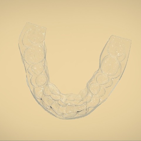 Download 3D printer model Digital Anti Snoring Splint ・ Cults