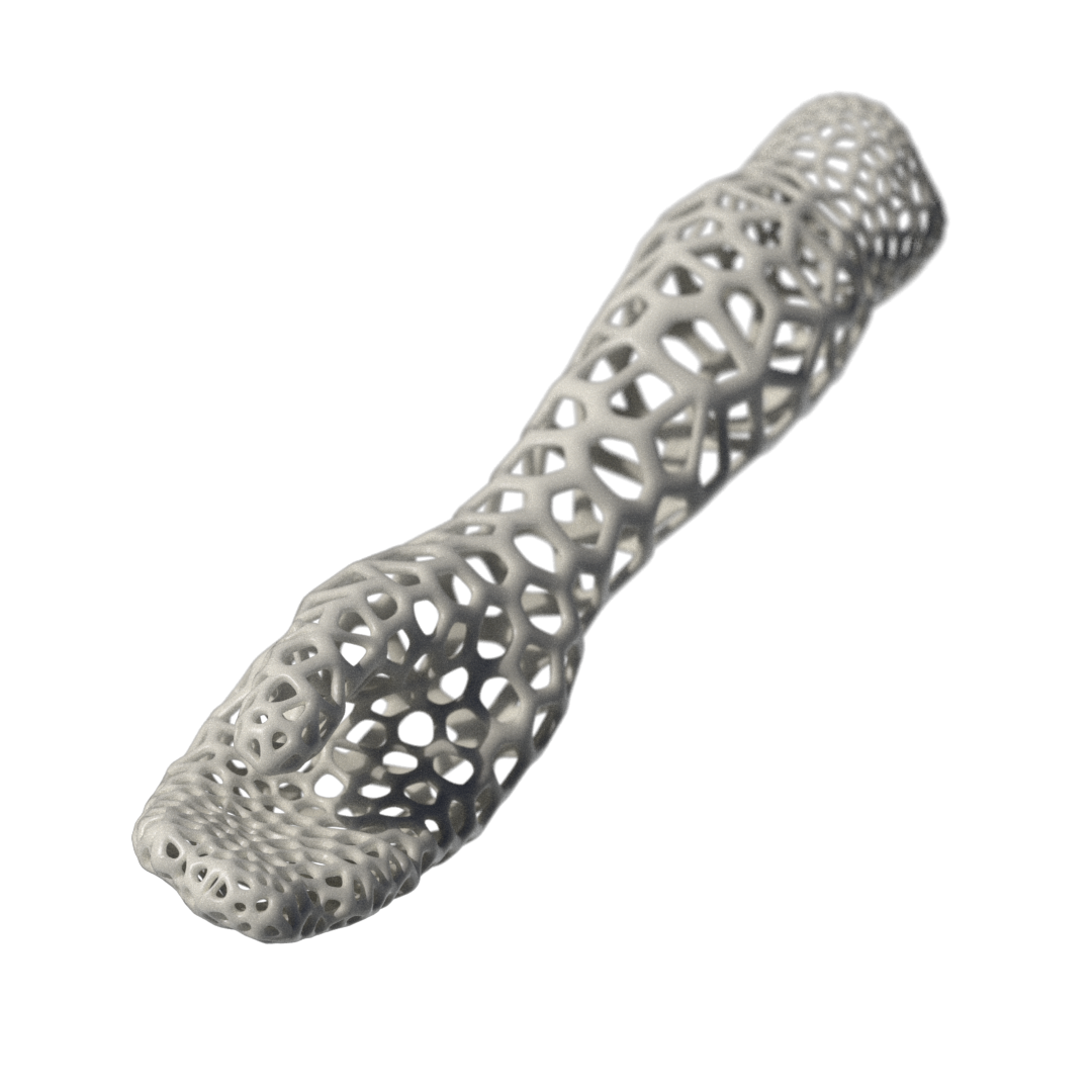 Free STL file Prosthetic Arm・Design to download and 3D print・Cults