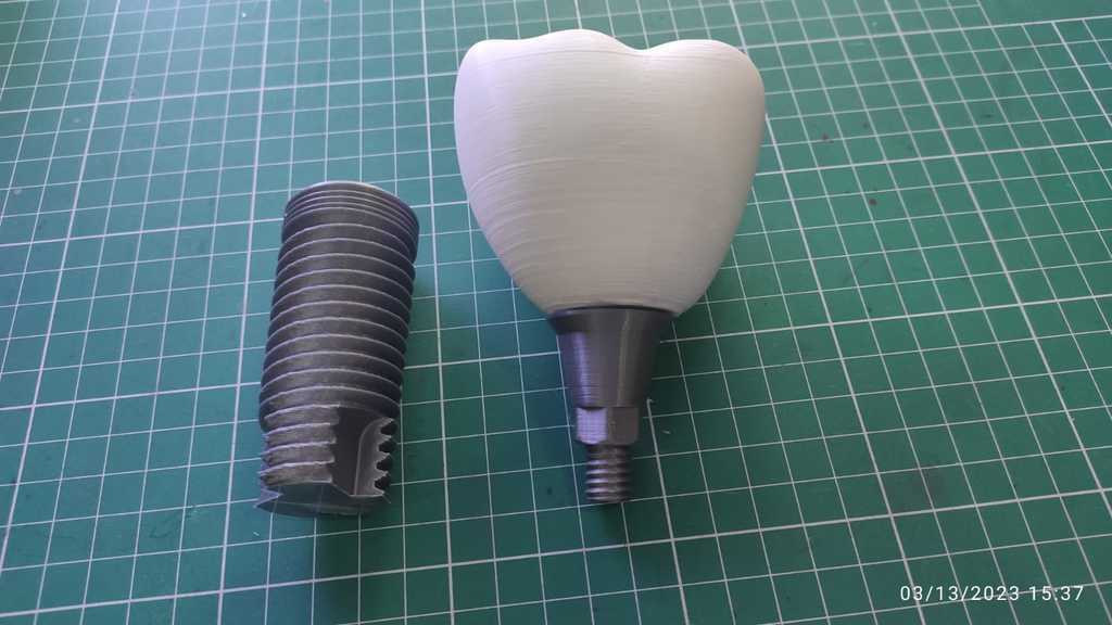 Free 3D file Dental Implant model - Complete set・3D print design to ...