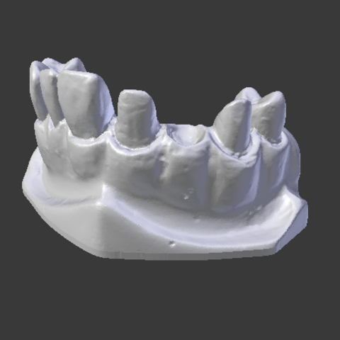 Download STL file Dental model prosthesis ・ Cults
