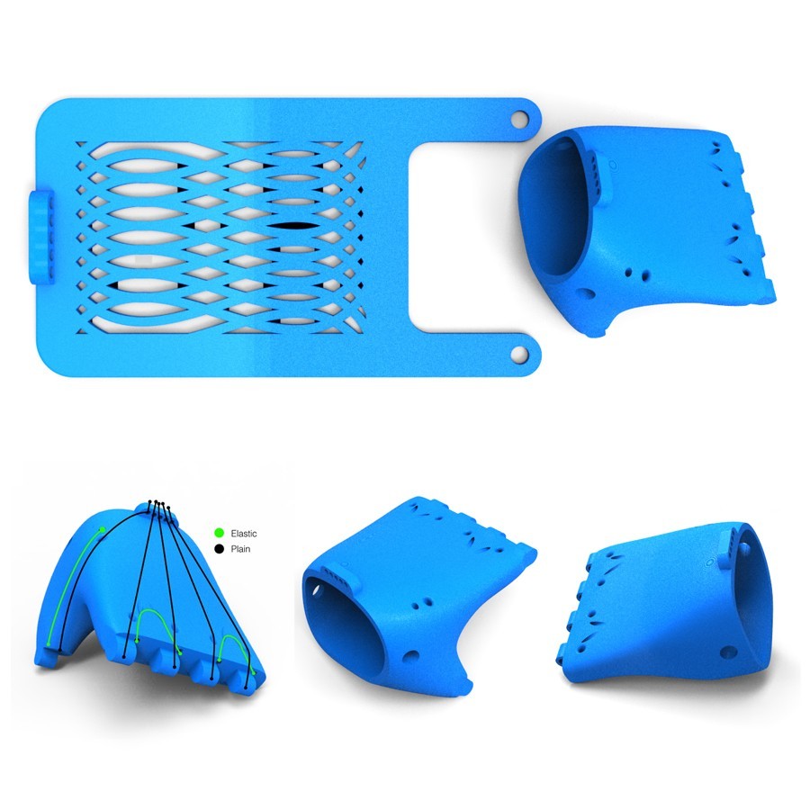 Free STL file Fusion Hand / Prosthetic hand・3D printable model to ...