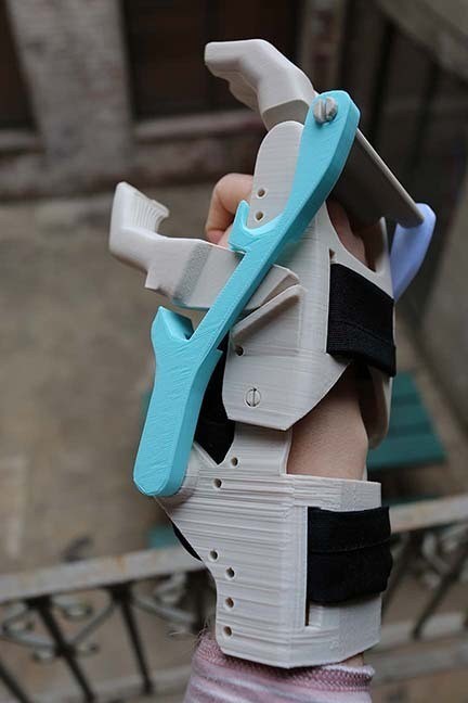 Free STL file Mechanical Prosthetic Concept Model・3D print object to ...