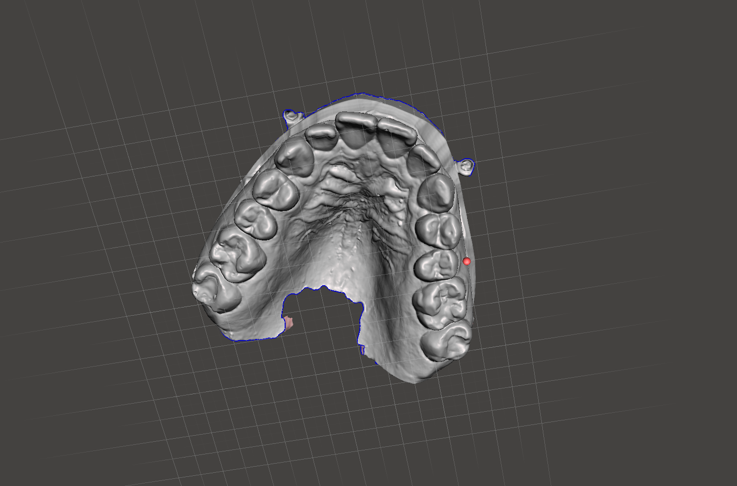 STL file Orthodontics dental model・3D printable model to download・Cults