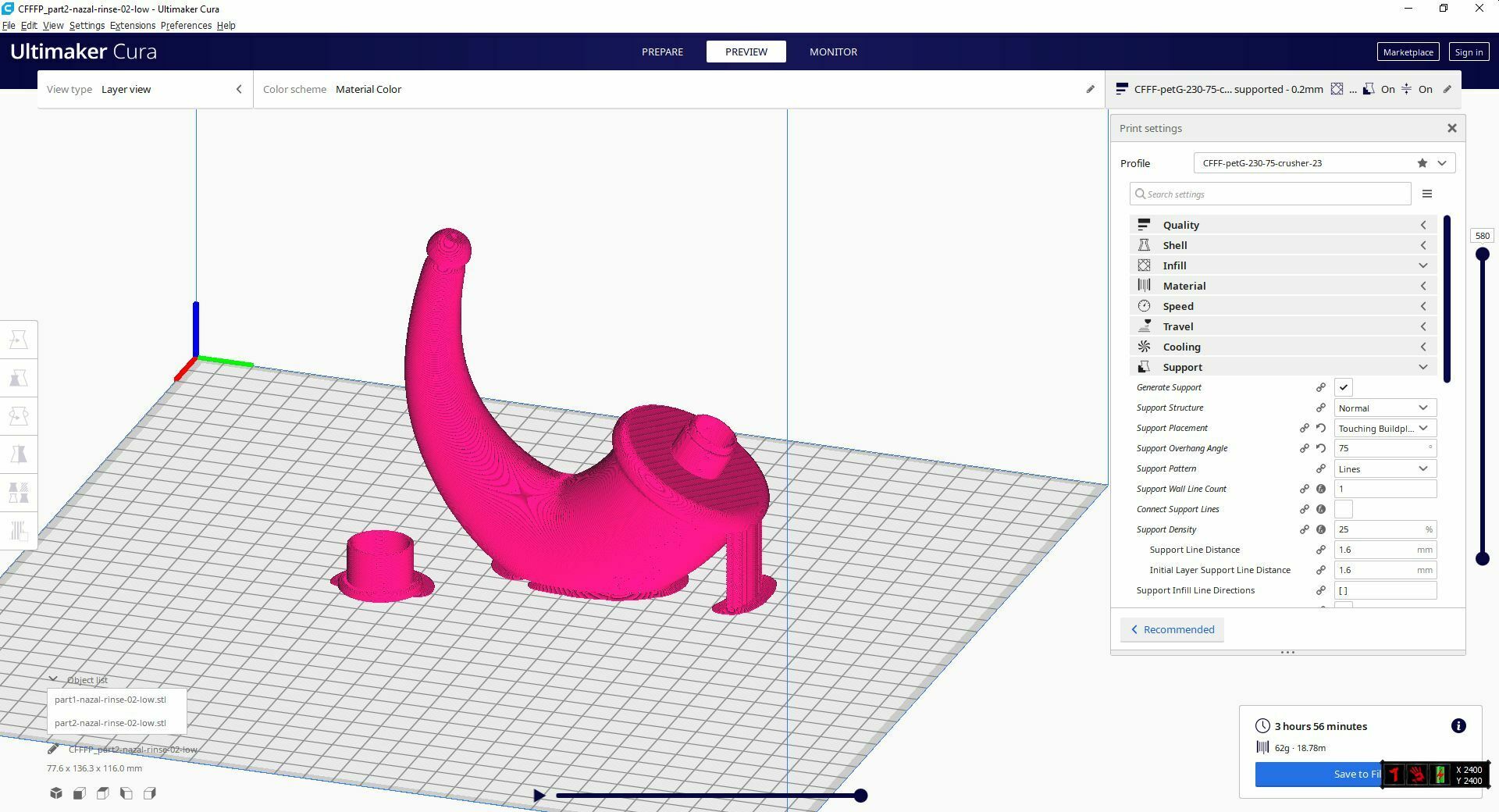 STL file Nasal Rinse Sinus sanitizer anti-coronavirus Irrigation ...