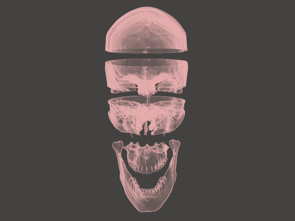 STL file HD Anatomical Skull 5 parts・Model to download and 3D print・Cults