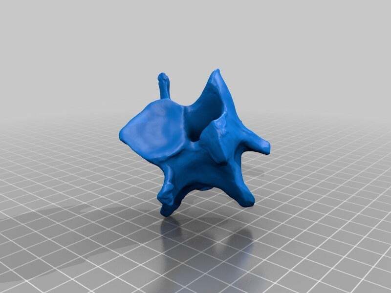 Archivo STL gratis Vértebra del cuello・Modelo para descargar y imprimir ...