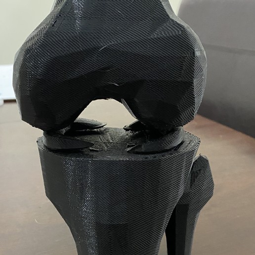 Download STL file Knee • Object to 3D print ・ Cults