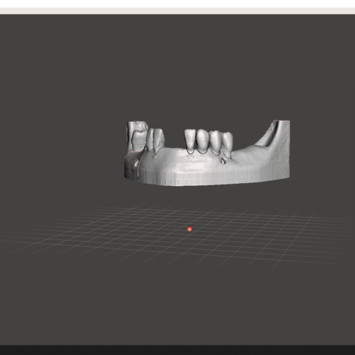 Download STL files Mandible with removable teeth ・ Cults