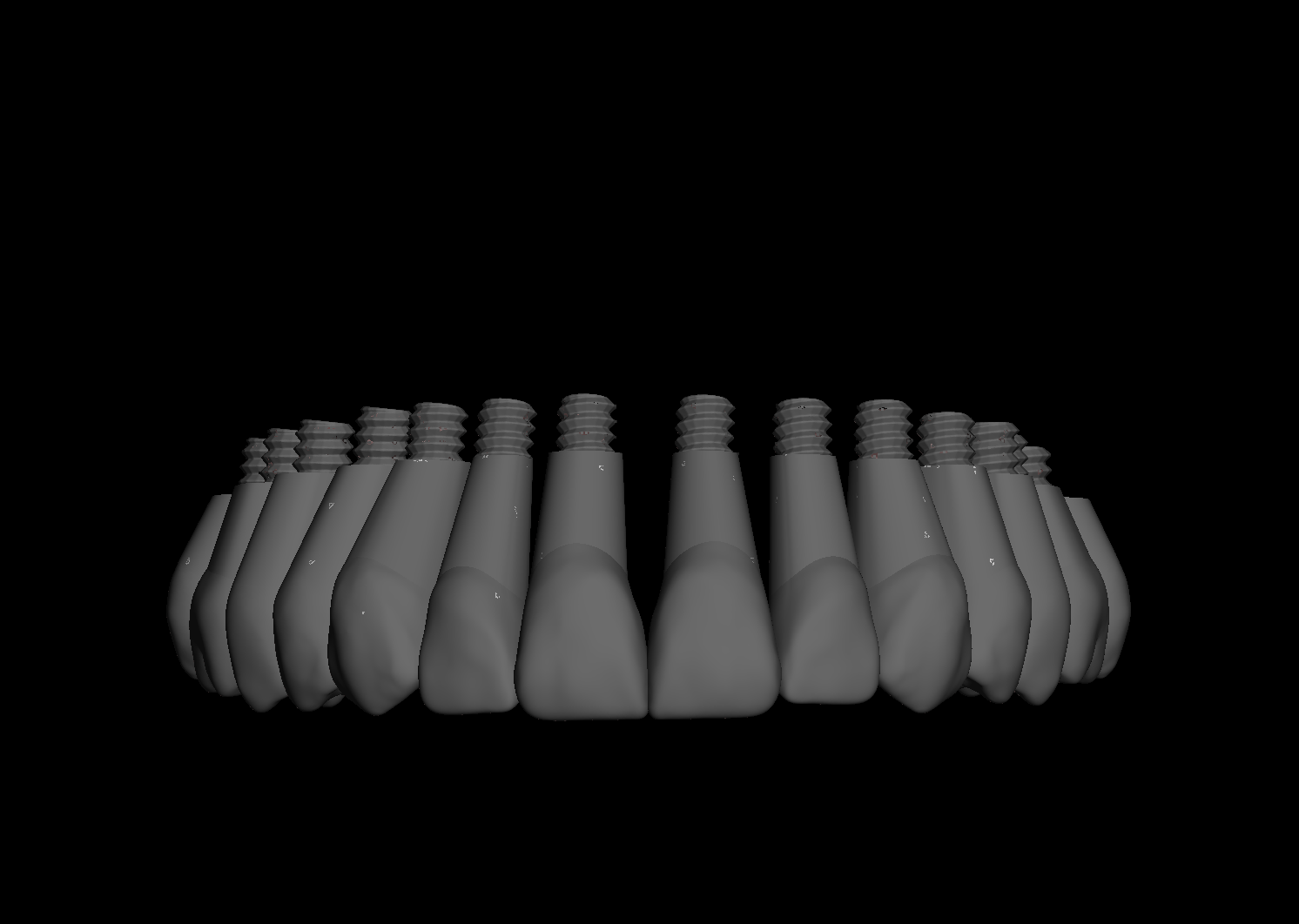 STL file Dental Model with detachable teeth・3D printer design to ...