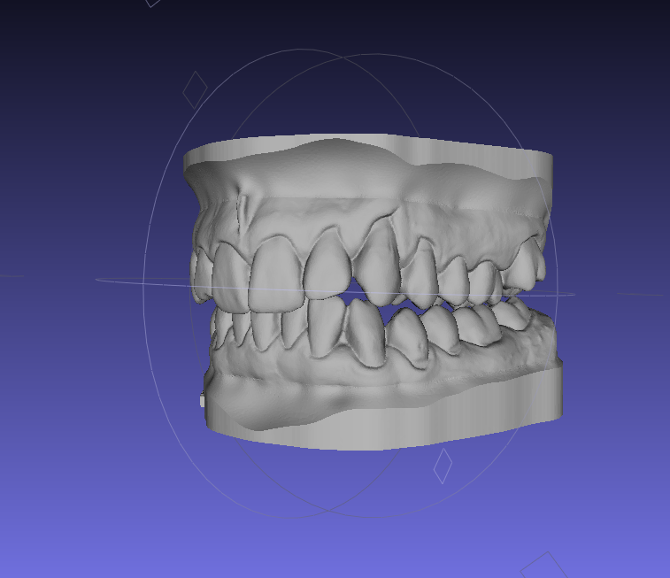 STL file Dental model, mouth, teeth・3D printer design to download・Cults