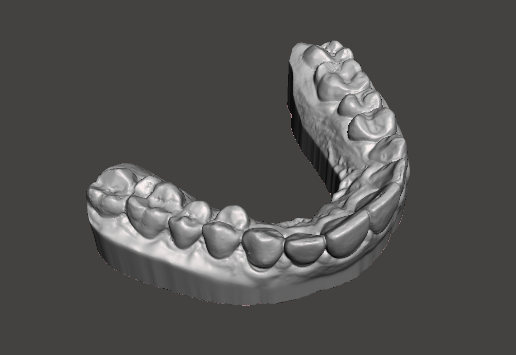 STL file Dental models・3D print design to download・Cults
