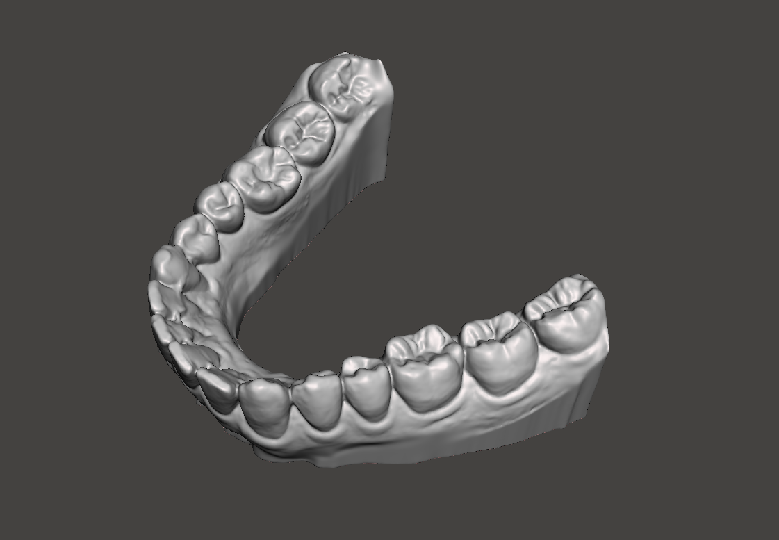 Archivo STL MODELO DENTAL・Modelo de impresión 3D para descargar・Cults