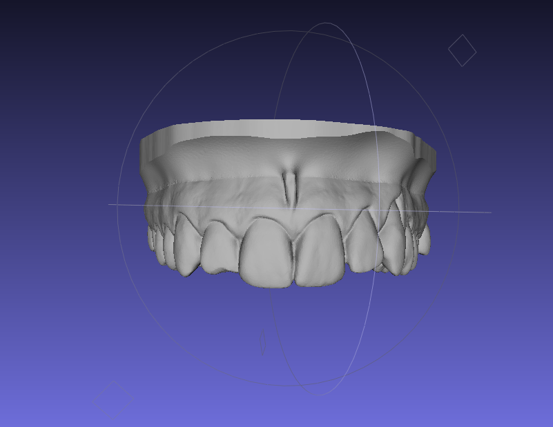 STL file Dental model, mouth, teeth・3D printer design to download・Cults