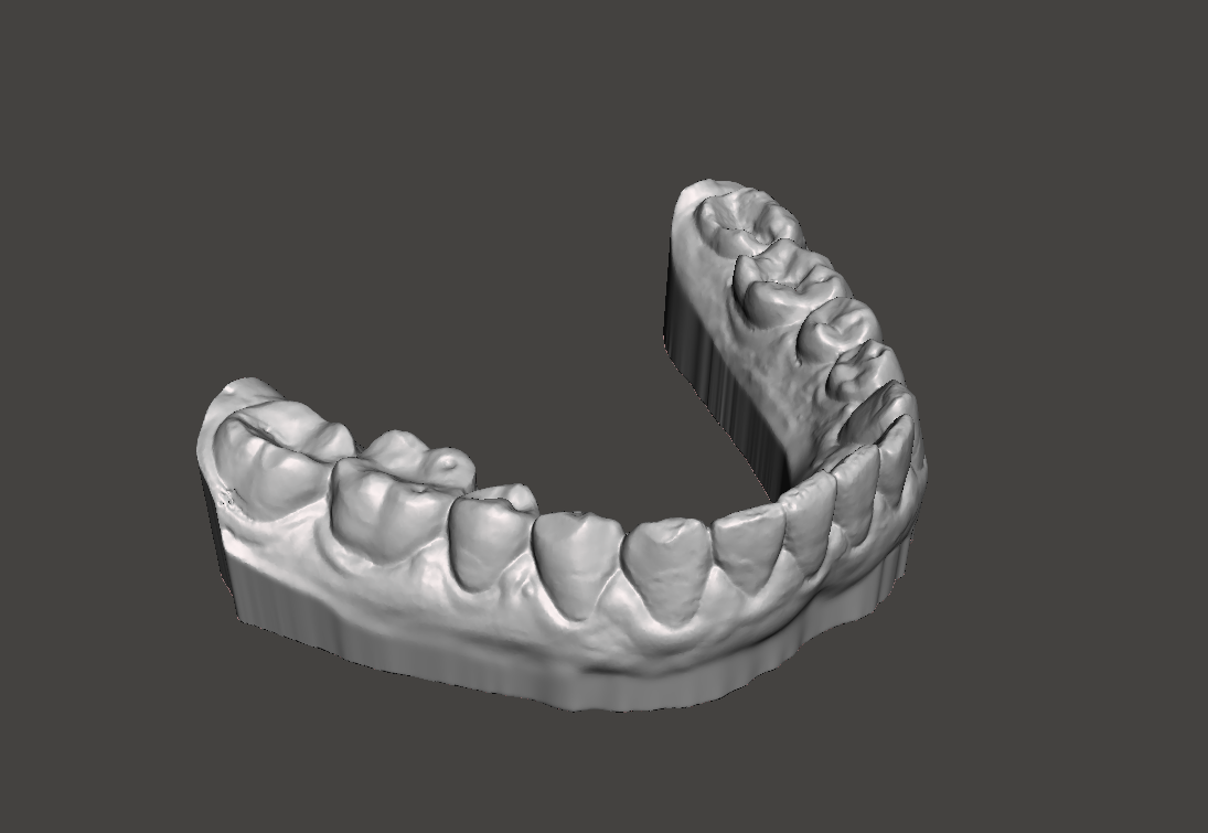 STL file Dental models・3D print design to download・Cults