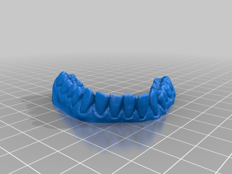 STL file nice dental model・3D print model to download・Cults
