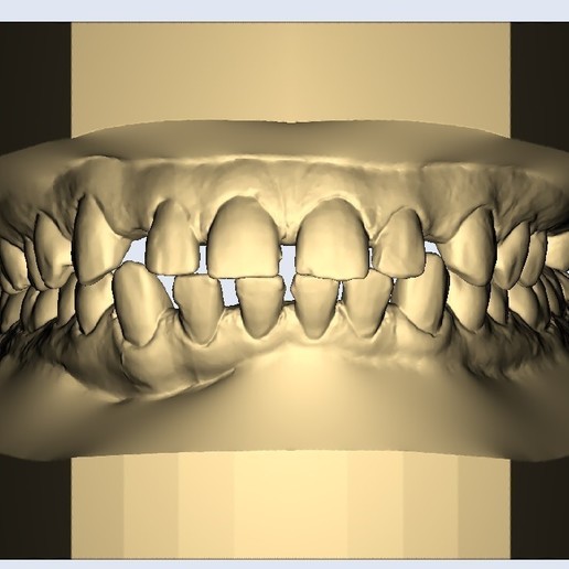 Descargar modelos 3D modelo dental mandíbula grande africana ・ Cults