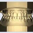 Download 3D printer model dental model nice ・ Cults