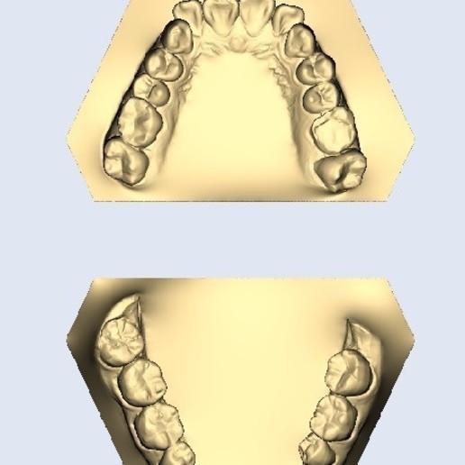 Télécharger STL prognathous adj - prognathe ・ Cults