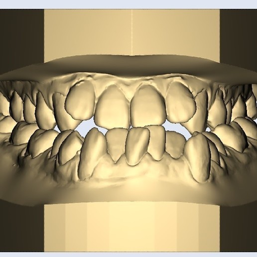 Télécharger STL prognathous adj - prognathe ・ Cults