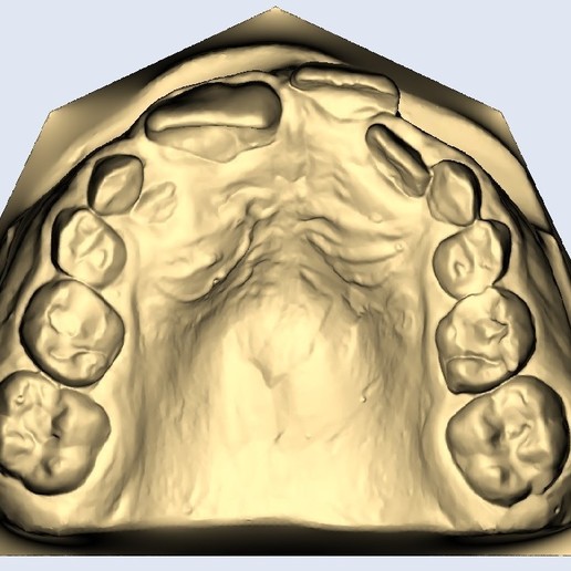 Download STL file big central teeth - dental fusion • 3D printer design ...